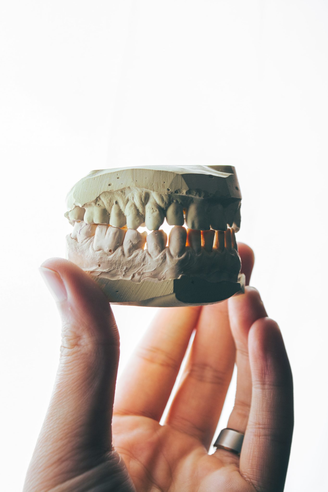 What Causes Tooth Decay l 5 Reasons For Tooth Decay l